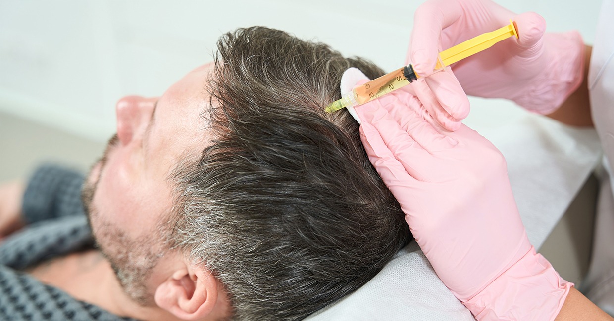 Hair Fillers - Advanced Aesthetics Clinic & Training School